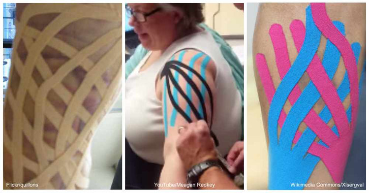 How to Do Kinesiology Taping to Reduce Swelling for Lymphedema Patients ...