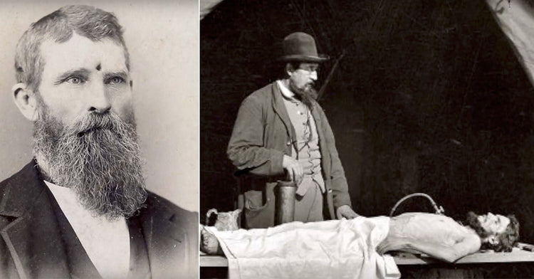 Jacob Miller Volunteered To Fight For The Union, Was Shot In The Head ...
